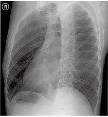 CE4RT - Radiographic Positioning of the Chest for X-ray Techs