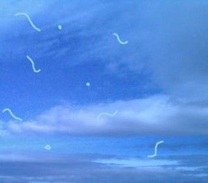 ¿Qué son las miodesopsias?