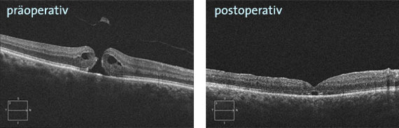 Netzhaut - Augenchirurgie, Fachärztin für Augenheilkunde und Optometrie