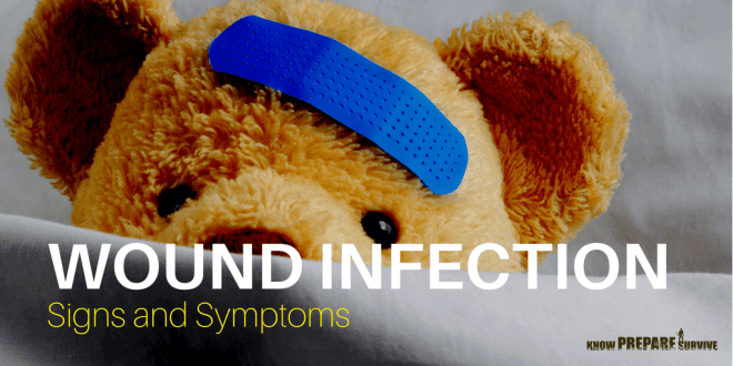 Wound Infection Signs and Symptoms - How to Catch Infections Early