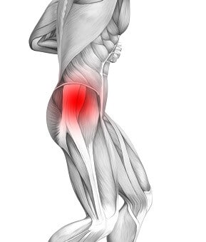 Effective TFL Release Technique For Tight Hips {Works Immediately ...