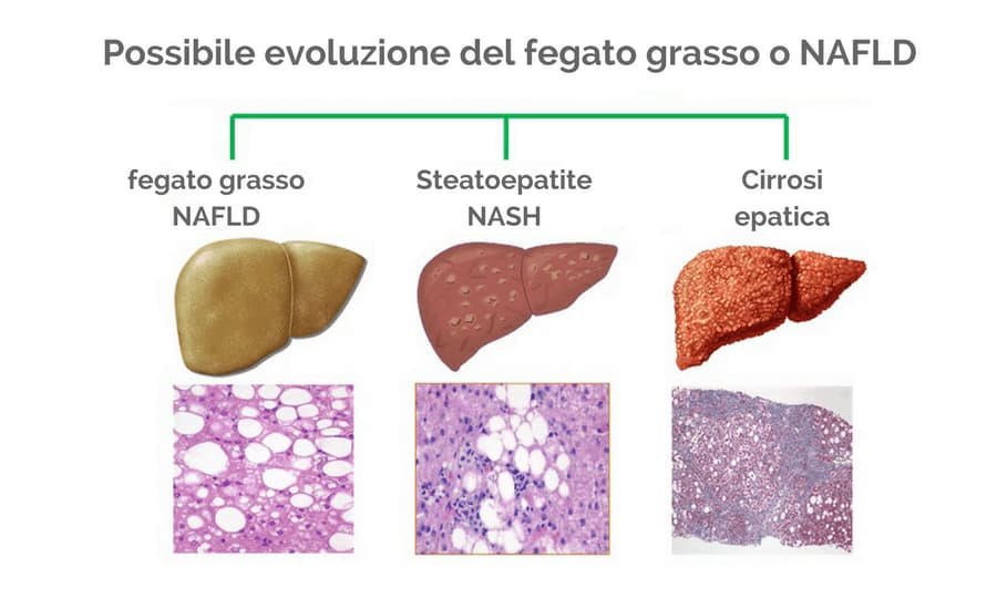 Fruttosio: cos'è, dove si trova e perché è dannoso per la salute