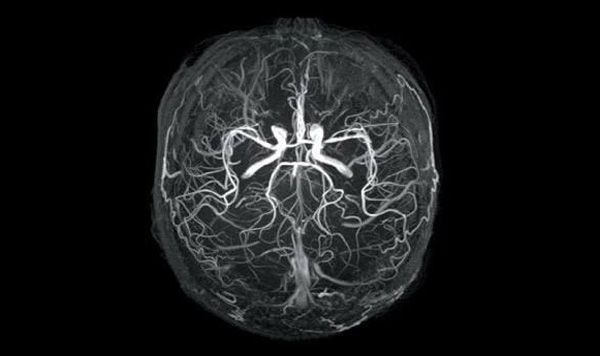Angioresonancia de Cerebro con contraste - PREVENTOR - Ecografía ...