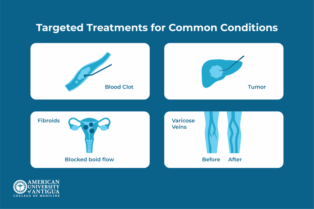 What Is Interventional Radiology? Procedures and Treatments