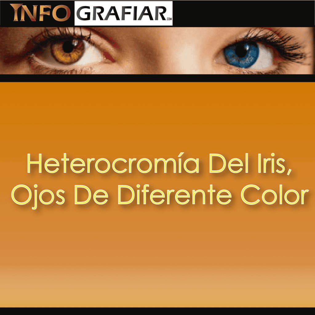 Heterocromía Del Iris, Ojos de Diferente Color - INFOGRAFIAR