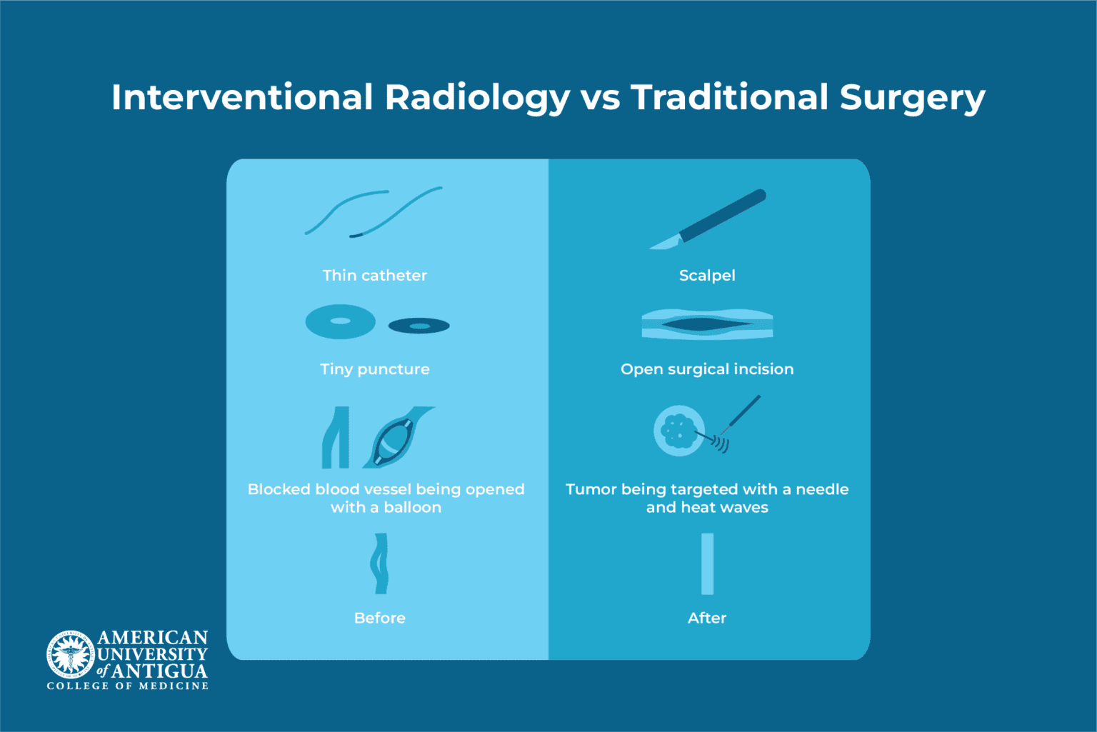 What Is Interventional Radiology? Procedures and Treatments