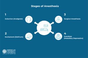 Stages of Anesthesia: From Induction to Recovery - American University ...
