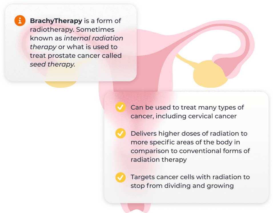 Internal Radiation Therapy (brachytherapy)