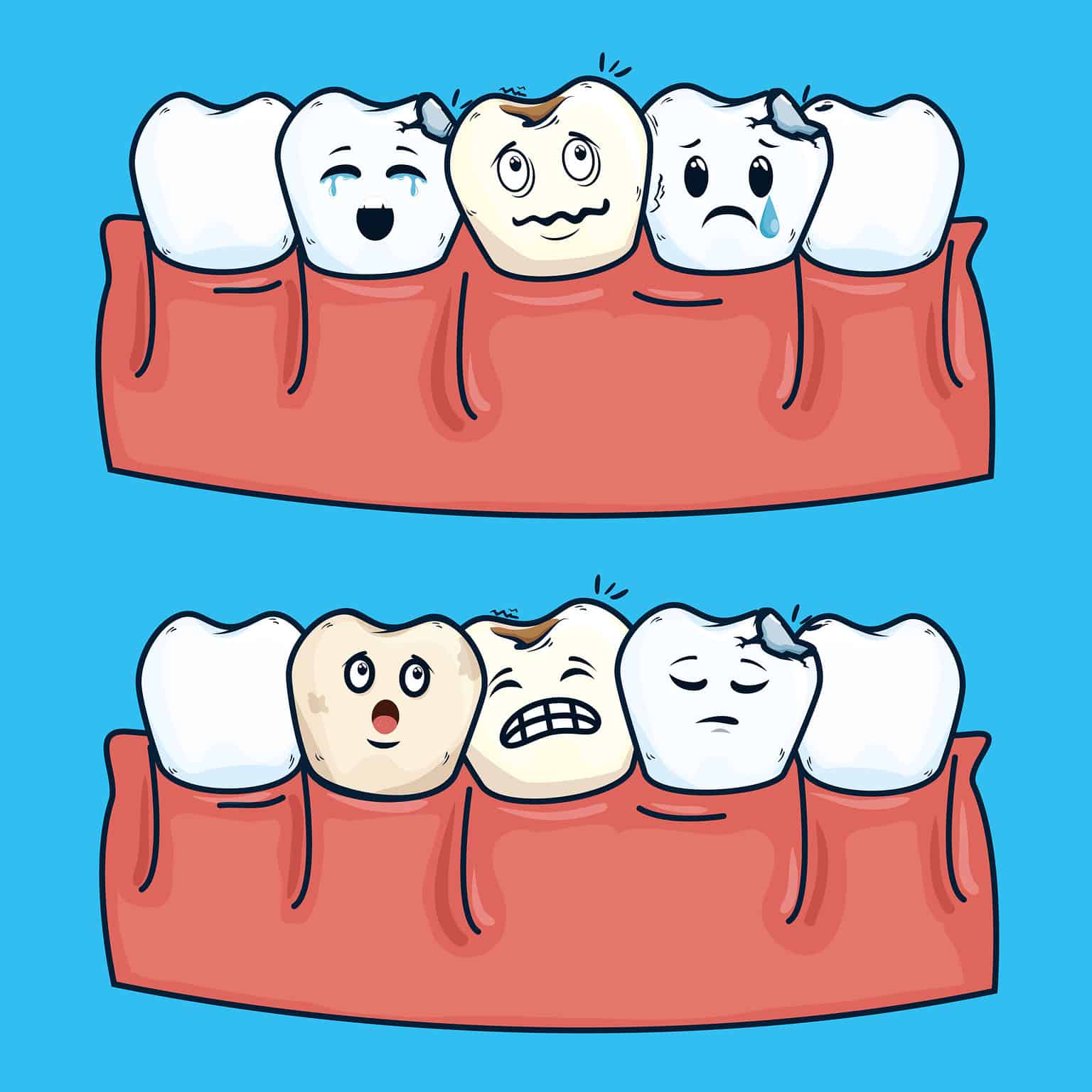 The Impact of Crowded Teeth on Oral Health · The Inspiration Edit
