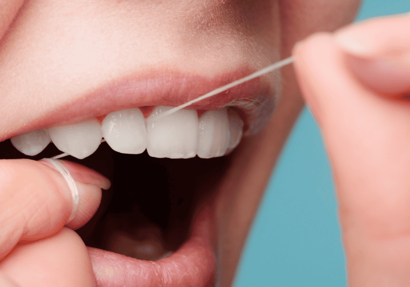 Filo interdentale come si usa » L'alchimia del sorriso