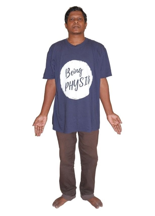 Anatomical positions definition with diagram, examples Its terminology ...