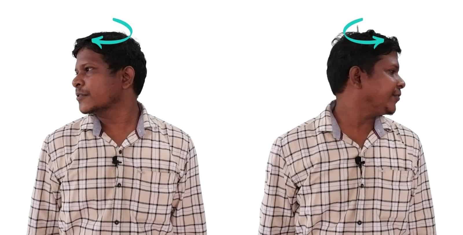 To Fix Reverse Cervical Lordosis Follow These 5 Easy Exercises