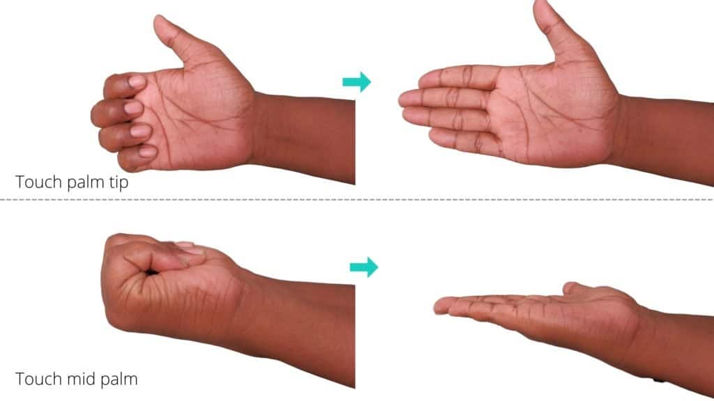 5 Easy Dupuytren's Contracture Exercises for Finger Pain Relief