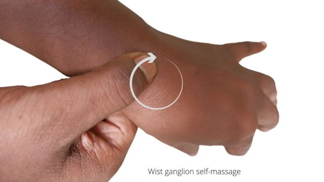 These 3 Easy Ganglion Cyst Wrist Exercises will Remove Lump Without Surgery