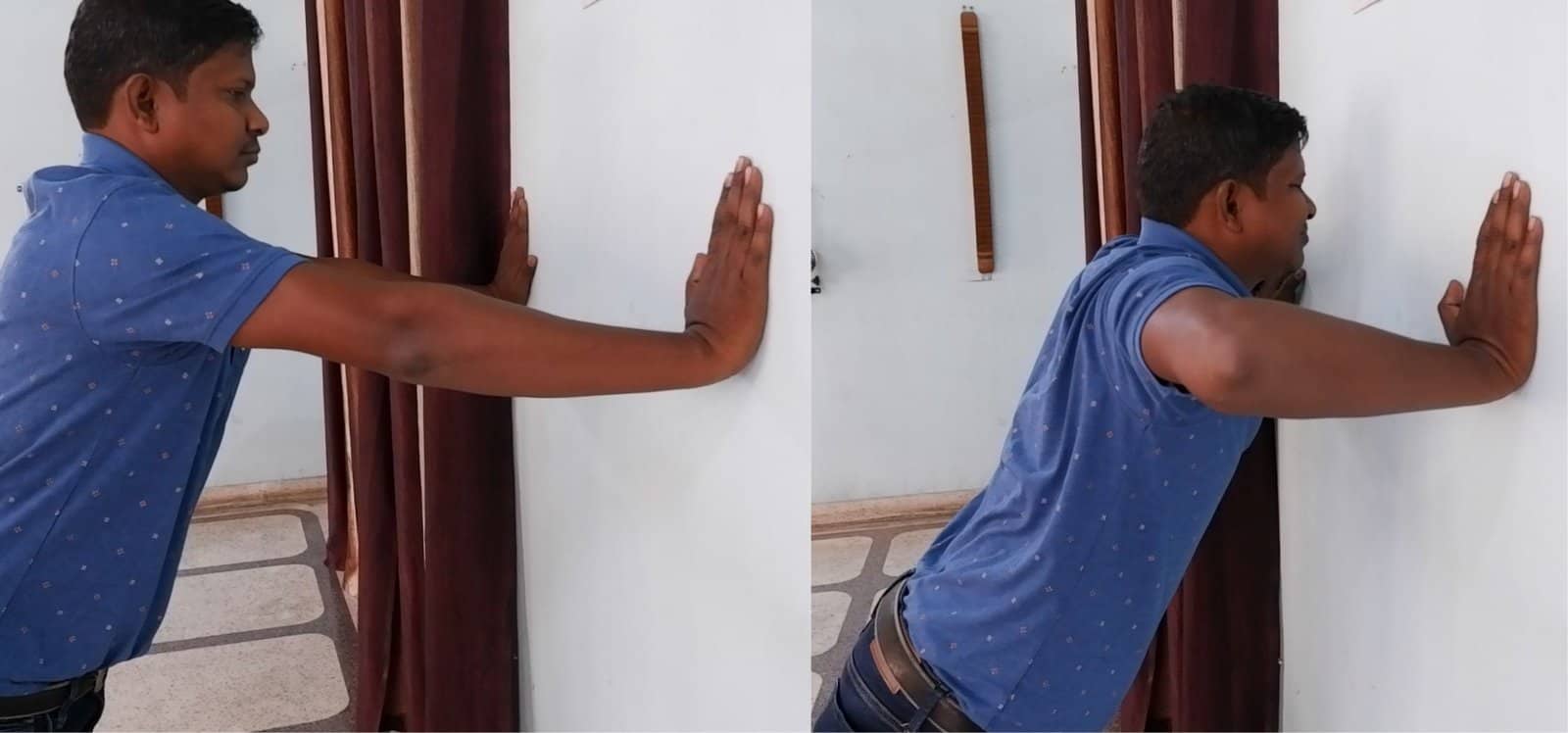 6 Super Easy Exercises for Winging of Scapula Permanent Fixation