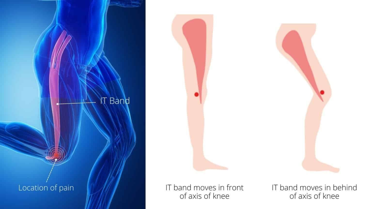 8 Effective IT Bands Stretch to Get Back to Field Early