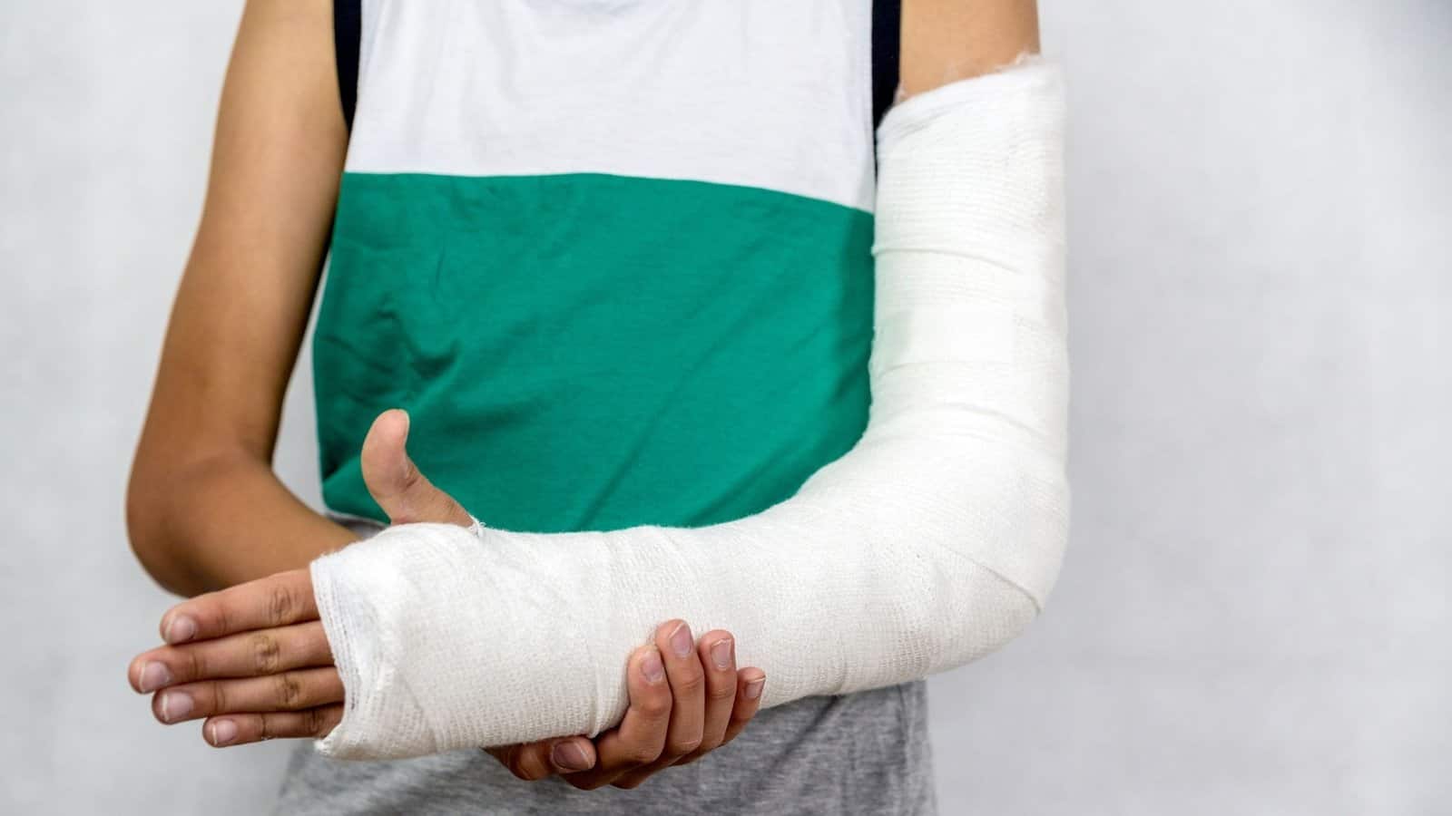 9 Easy shaft of humerus fracture exercises & physiotherapy management