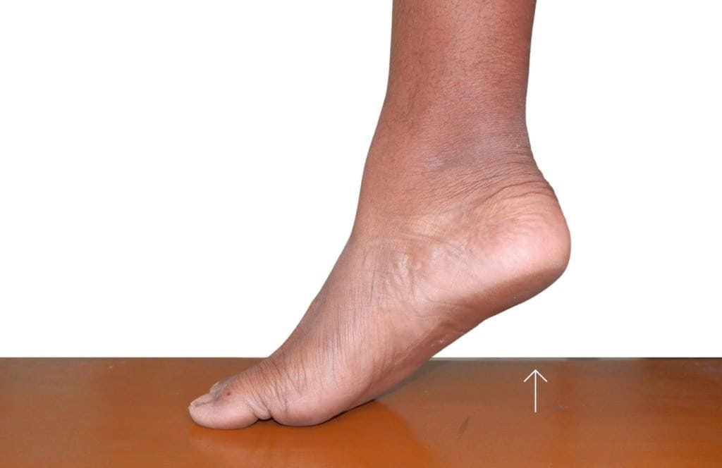4 Easy Exercises for Hallux Valgus| Bunion Pain Relief in Great Toe
