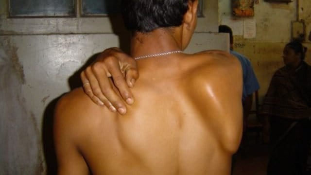 6 Super Easy Exercises for Winging of Scapula Correction