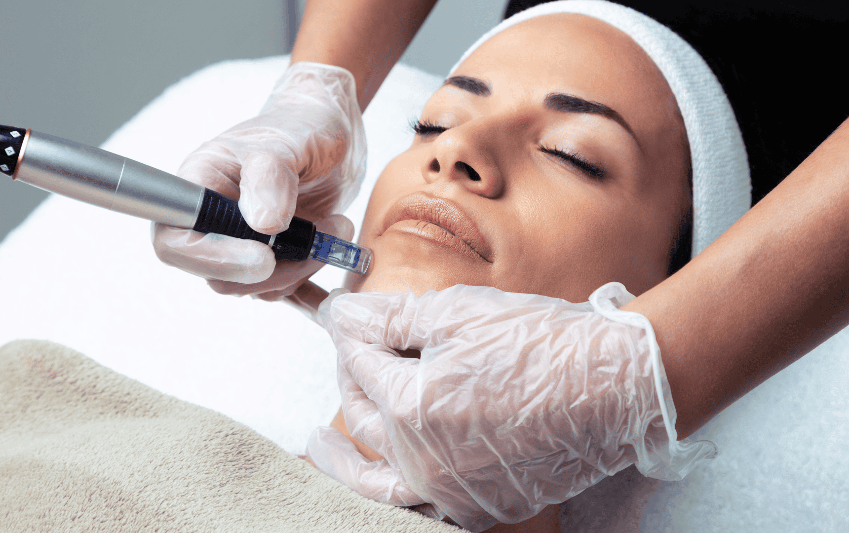Microneedling: A Lucrative Career Path in the Beauty Industry