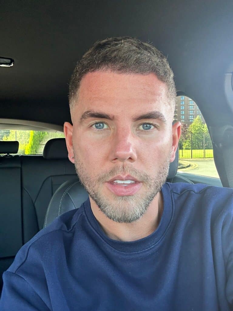 Dean McCullough Hair Transplant at KSL Clinic // See the results here