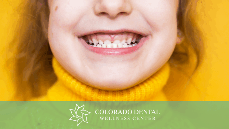 Overbite, Underbite & Crossbite: What’s Normal? | Clermont Dental