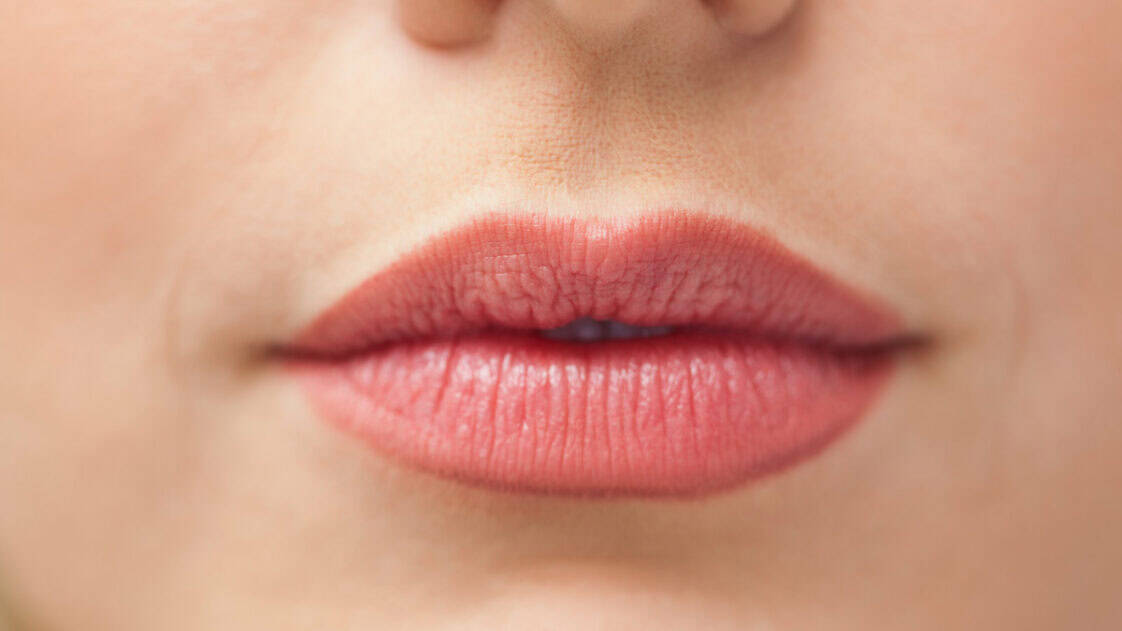 How To Get Rid Of Chapped Lips Without Chapstick or Other Lip Balm ...