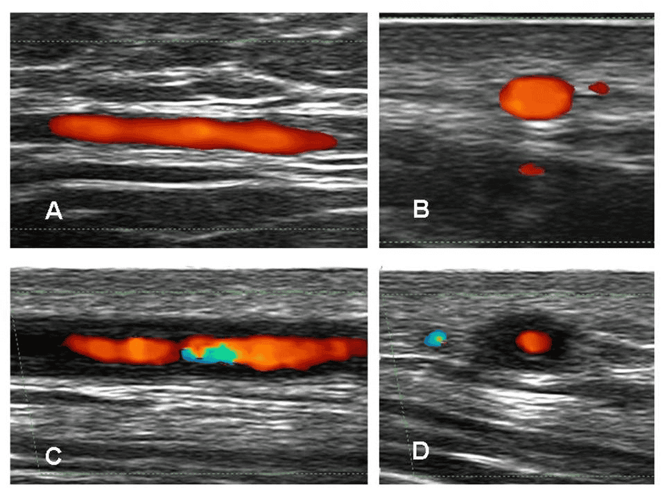 Cerebrovascular Evaluations