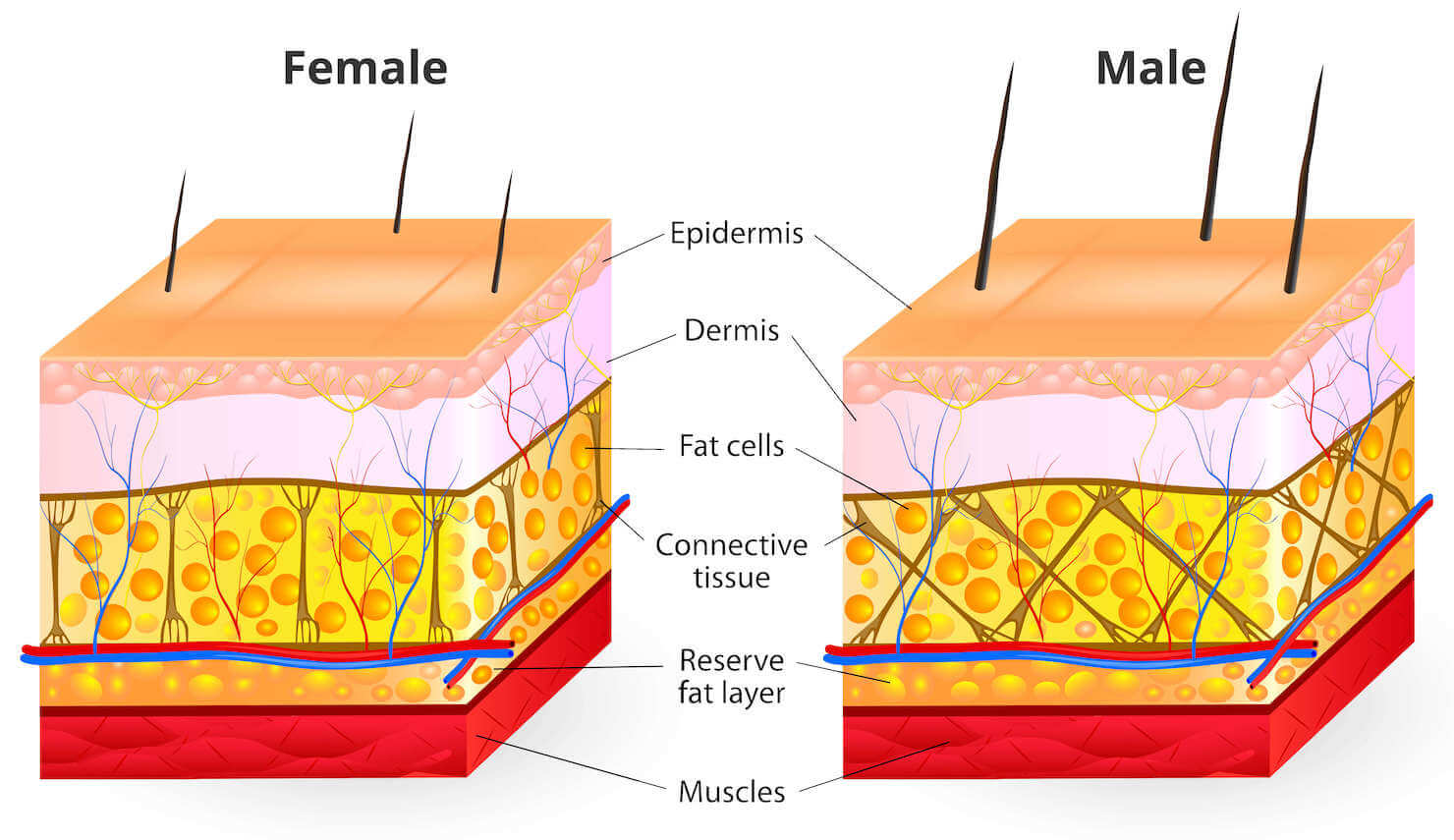 Surrey Cellulite Treatments w/ Latest Tech | Vancouver Cellulite ...