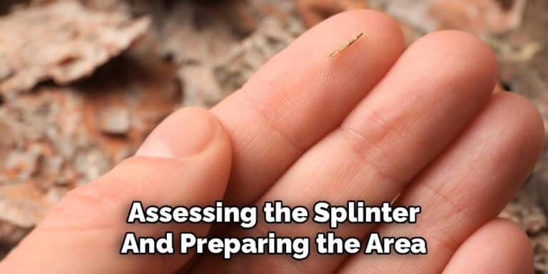 How to Remove Wood Splinter | 10 Effective Methods (2026)