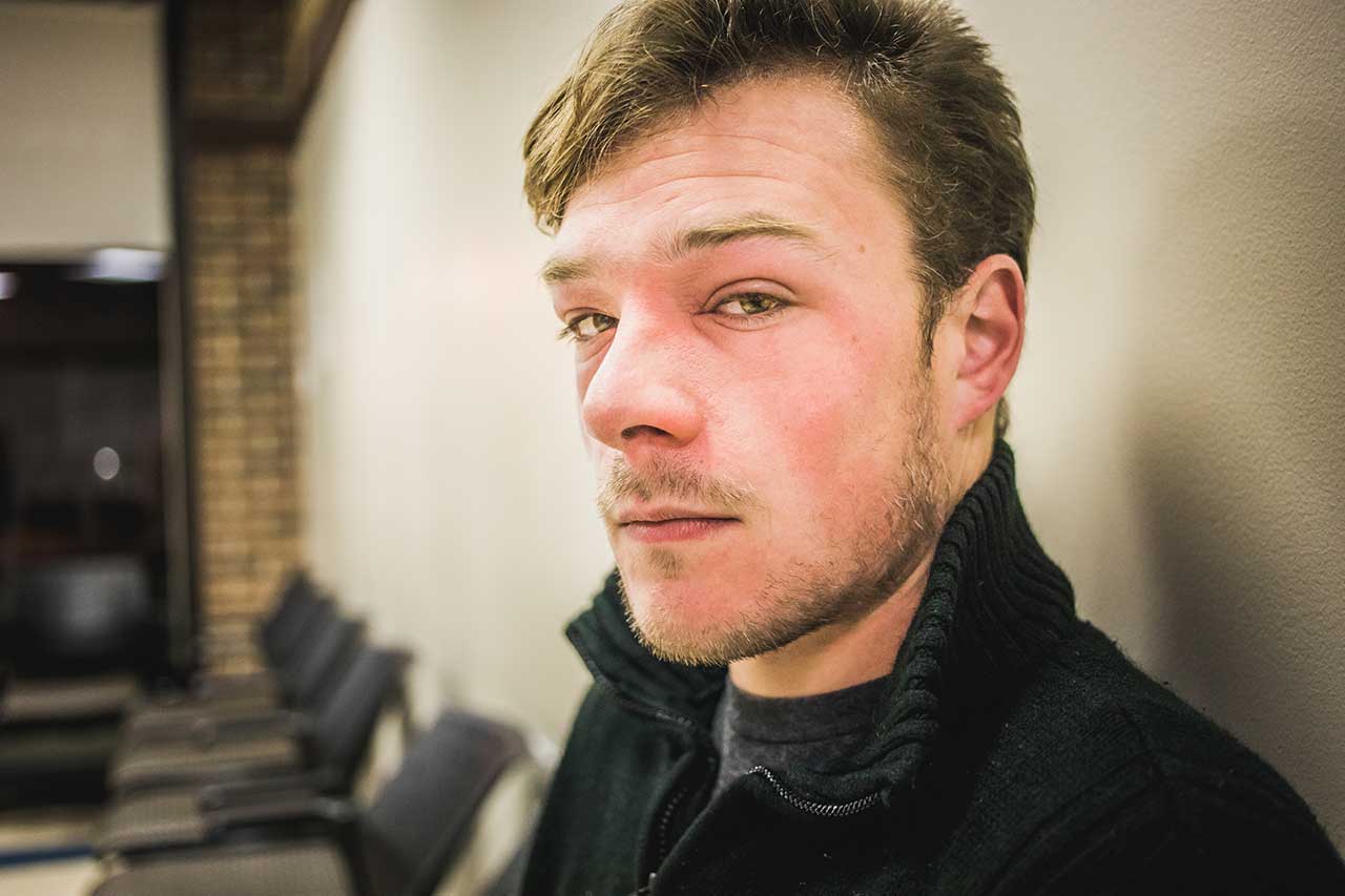 Dermite séborrhéique : Découvrez les causes, symptômes et traitements ...