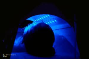 Red Light Therapy For Eczema: What The Science Says | Therapeutic Beams