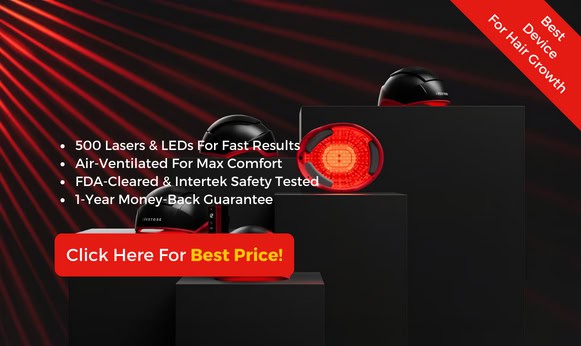 iRestore Elite Review: Is This The World’s Best Device For Hair Growth ...