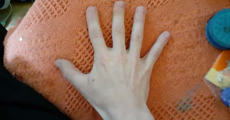 How to get RFID Chip Implant in Humans and practical uses with Arduino