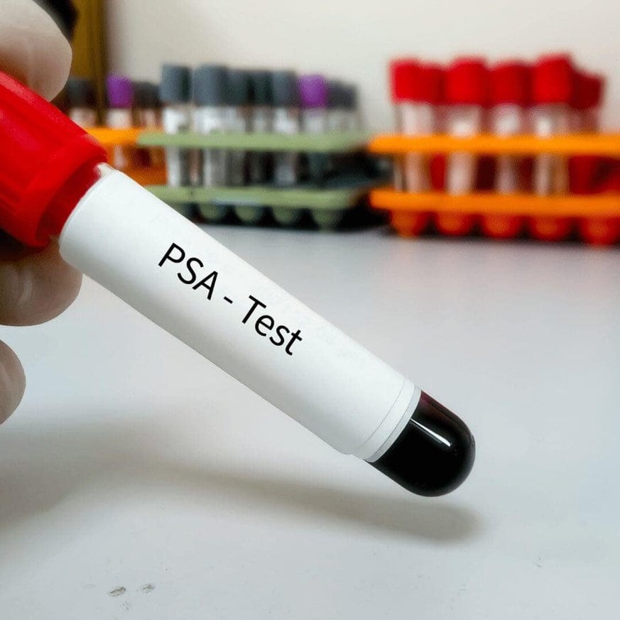 prostate examination gp