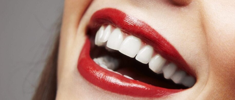 perfect white teeth