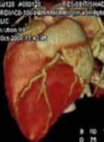 Slip Ring CT Pictorial Guide [helical, Cardiac, Perfusion, 4DCT] • How ...
