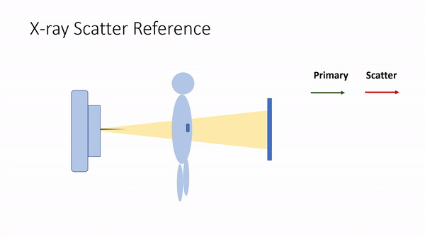 X-ray Scatter (collimation, KVp, Air Gap, Thickness, Anti-scatter Grids ...