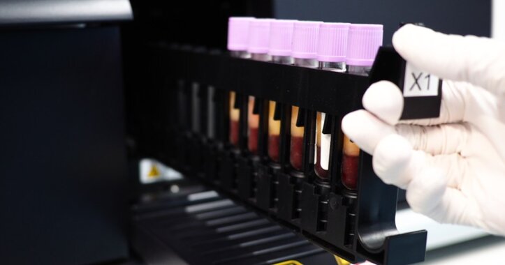 QuantiFERON TB Gold Plus Test IGRA Polo GGB Genomics Genetics And Biology quantiferon-tb-gold-plus-test-igra-polo-ggb-genomics-genetics-and-biology
