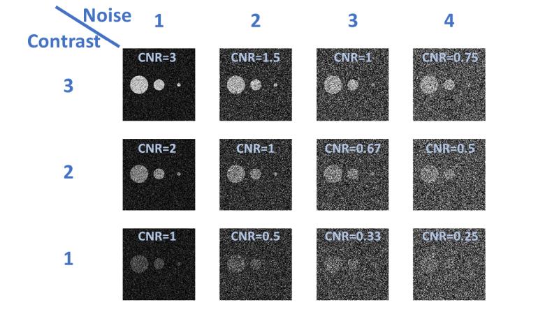 X-ray Contrast To Noise (CNR) Illustrated Examples Of Image Noise (SNR ...