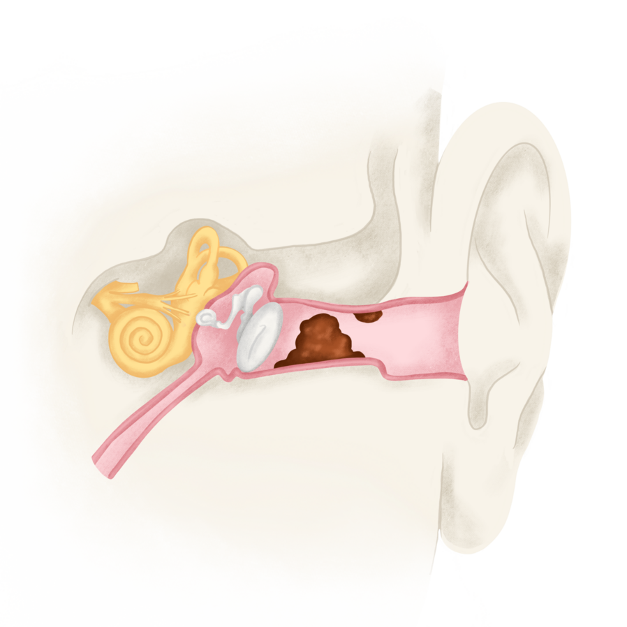 blocked ear