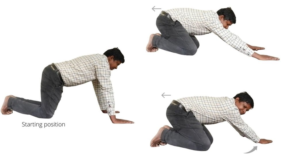 Scoliosis Exercises To Straighten Spine