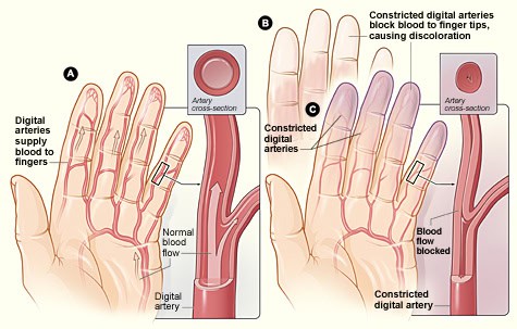 vascular hands