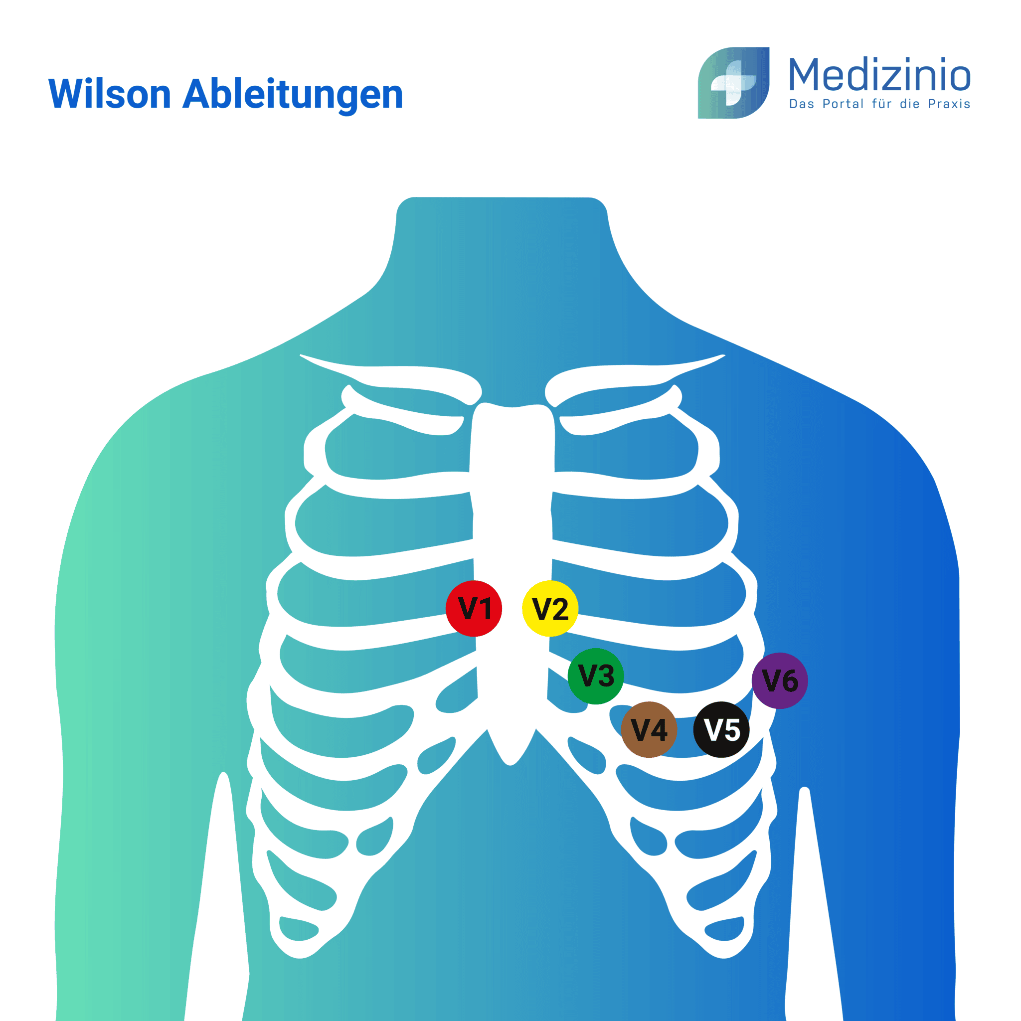 Ekg Anlegen Zum Ausdrucken | Übungen 12- Kanal-EKG – EPEOFG
