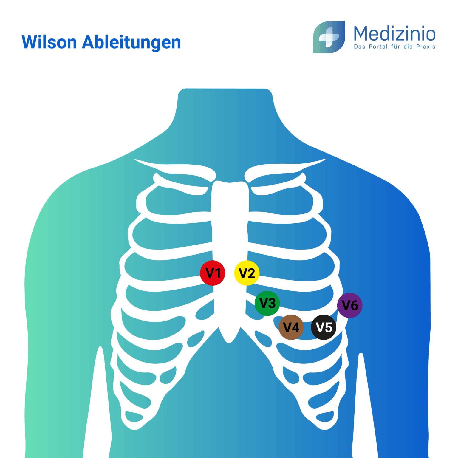 12 Kanal EKG anlegen (Anleitung + Bilder + Video)