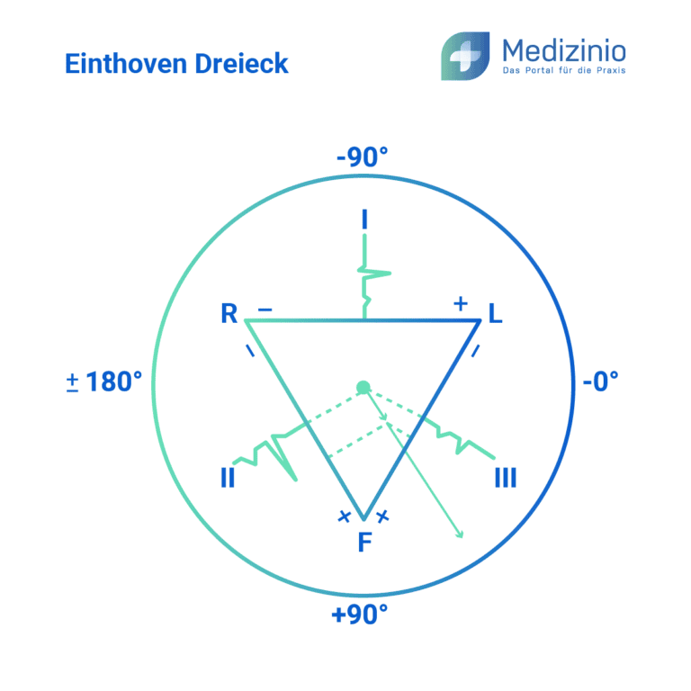 12 Kanal EKG anlegen (Anleitung + Bilder + Video)