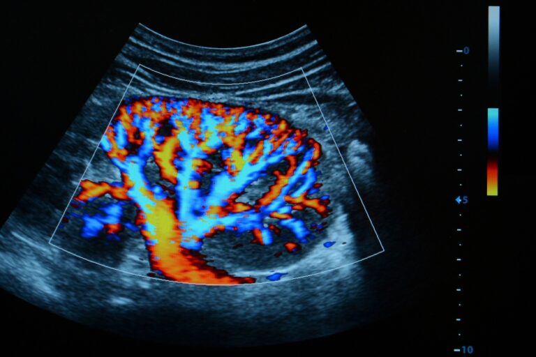 FKDS in der Medizin (Farb-Doppler und Farb-Duplex)