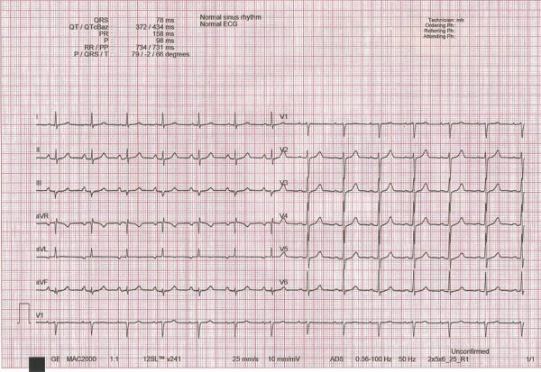 Das Ruhe-EKG: Ablauf, Bedeutung und Auswertung
