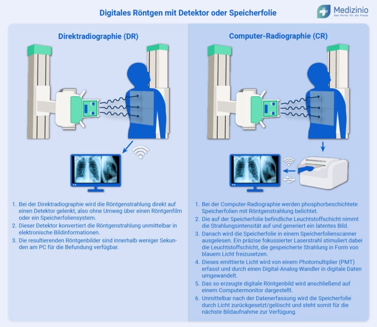 Digitales Röntgen: Vorteile und Nachteile