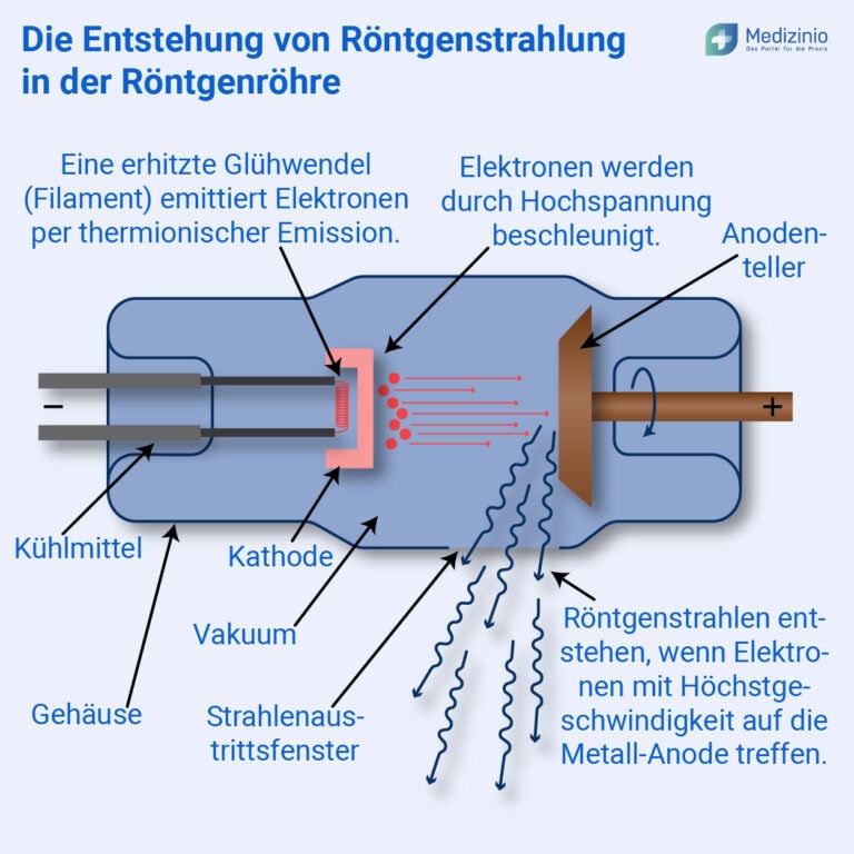 Röntgen-Thorax: Die Untersuchung von Lunge, Herz & Co.
